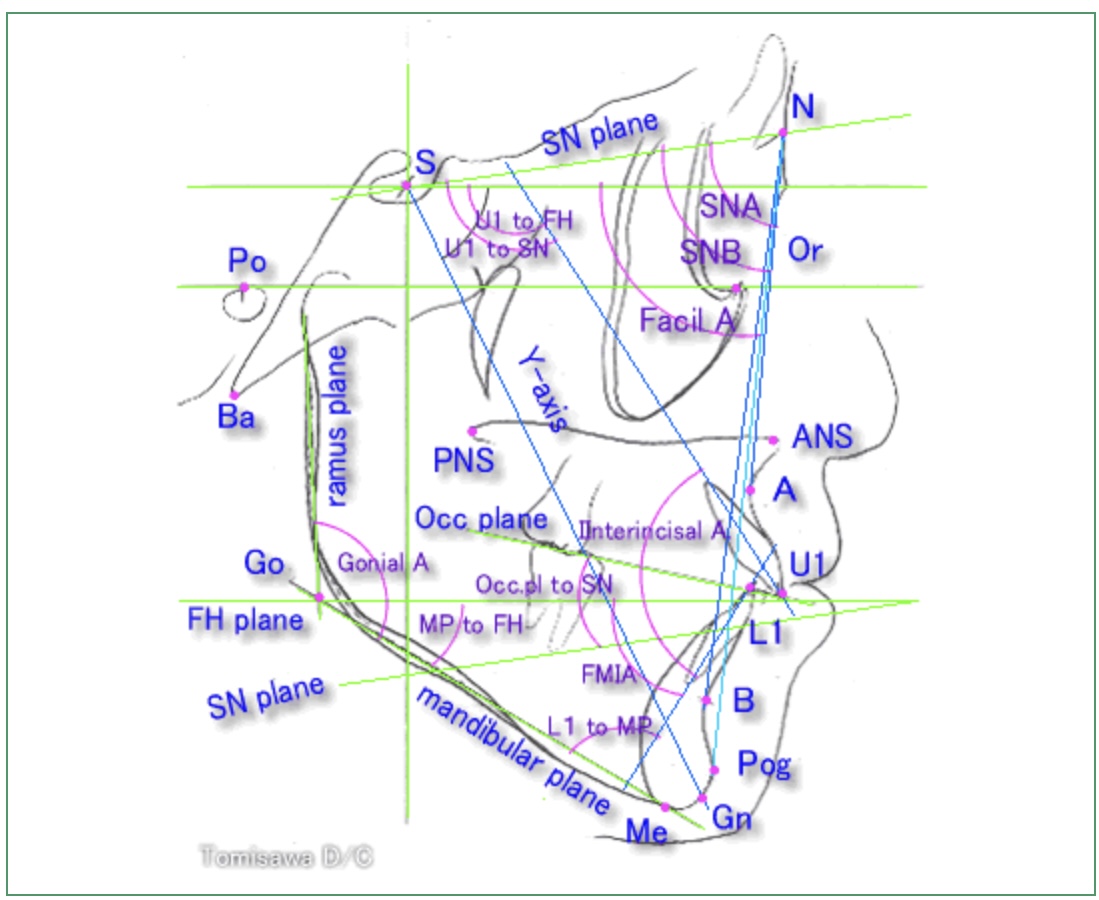 矯正治療に欠かせないセファロとは？ | 大阪市の歯医者なら「大阪くれあ歯科・矯正歯科」